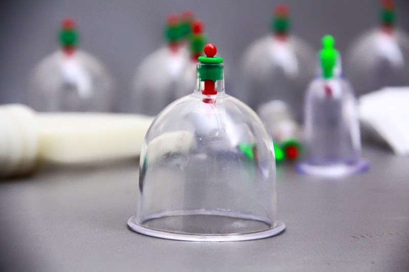 Cupping for Respiratory Problems - Philadelphia Acupuncture Clinic
